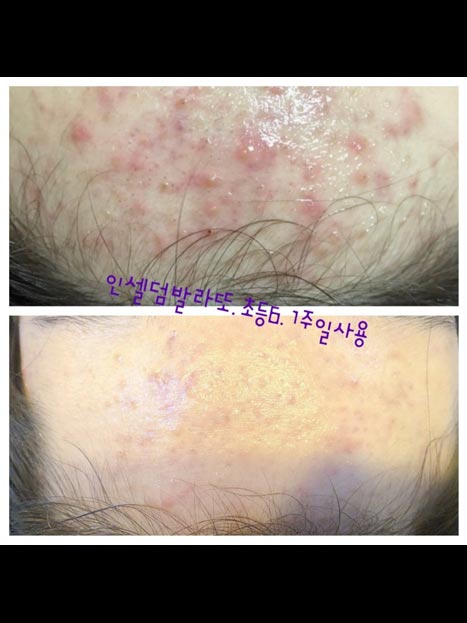 Incellderm Dermatology First Package: Booster 120ml and Serum 45ml Shop ...