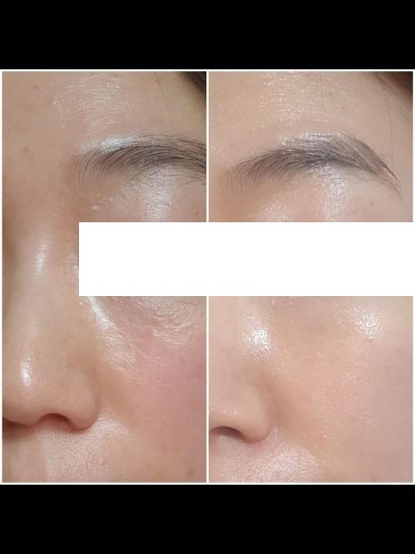 Incellderm Dermatology First Package: Booster 120ml and Serum 45ml Shop ...