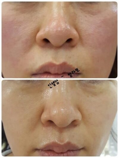 Incellderm Dermatology First Package: Booster EX 130ml + Serum EX 45ml ...